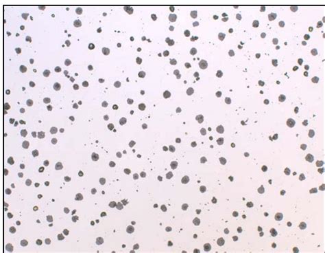 5 Microstructure Of Ductile Iron The Graphites Are