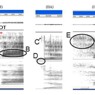 Spectrograms Of Normal And Atypical Production Of Stop Consonants I Download Scientific