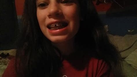 I Got Braces Youtube