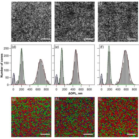 Cone Spectral Classification With Densitometry And Org Fig 9a And B