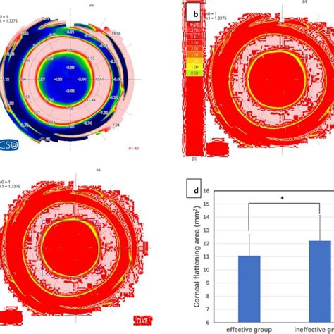 Tangential Difference Maps Were Using Month Topography Minus Baseline Download Scientific