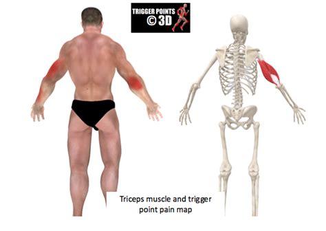 Trigger Point Of The Week Triceps