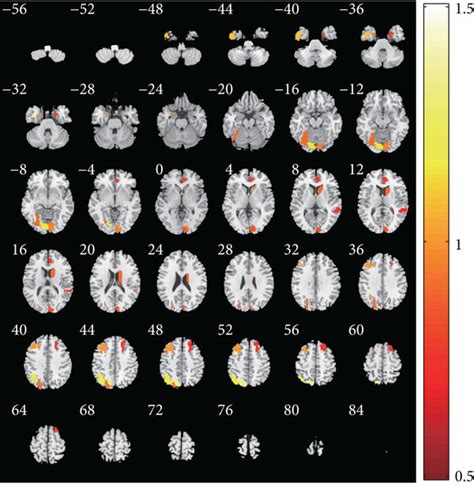 The Most Discriminative Brain Regions The Most Discriminative Regions Download Scientific