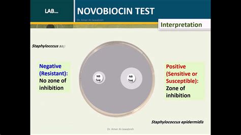 Coagulase Positive Staphylococcus Epidermidis