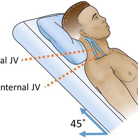A Normal Ecg Trace On The Top And Jugular Venous Jv Pressure Download Scientific Diagram