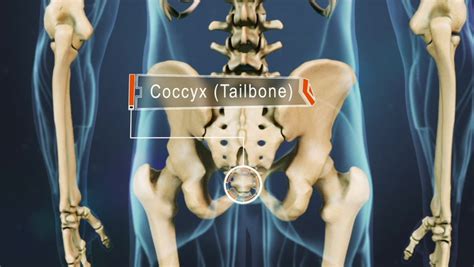 Understanding The Causes Of Tailbone Pain
