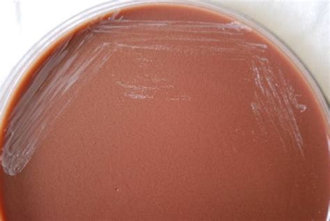 Brucella Abortus Pictures Getty Images