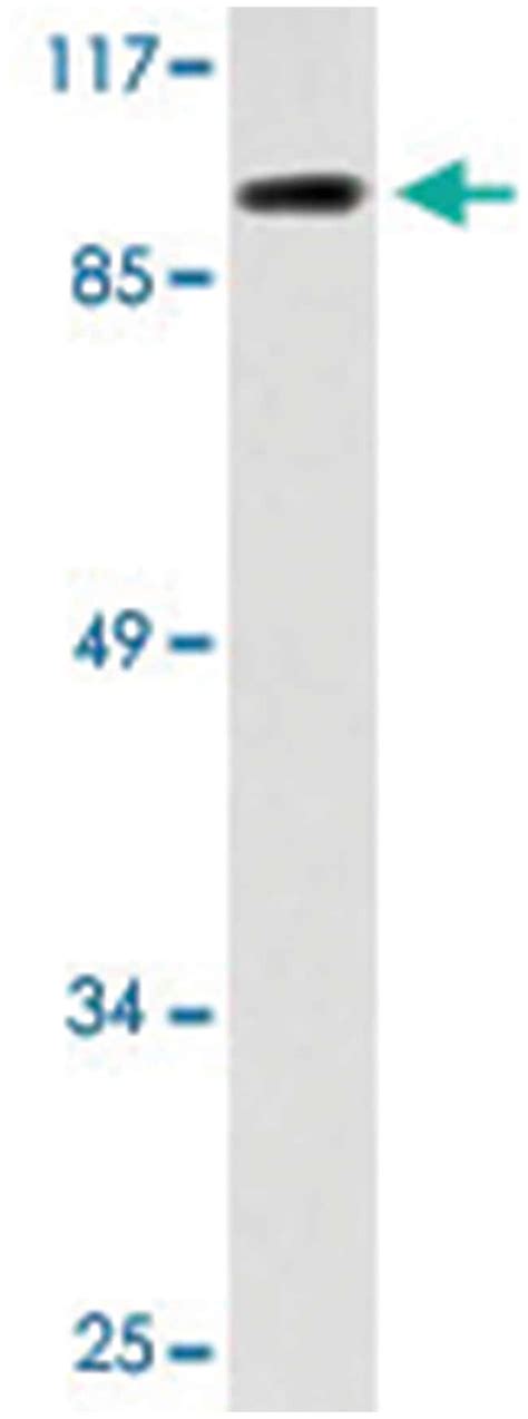 Kat2a Rabbit Polyclonal Antibody Abnova 100μl Unlabeledantibodies