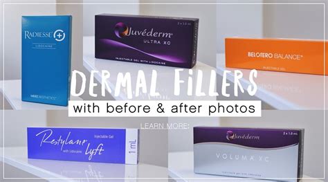 Fillers Brand Names At Mikayla Gascoigne Blog