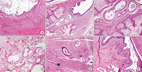 Photomicrograph With Hande Stain A High Power Field Hpf 10× Download Scientific Diagram