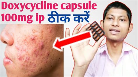 Doxycycline Capsule Mg Ip Monodox Mg Tablet Doxycycline Capsule Uses Side Effects Monodox