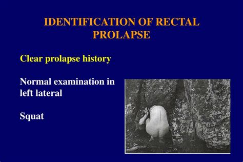 Ppt Rectal Prolapse Clinical Assessment Powerpoint Presentation Free Download Id