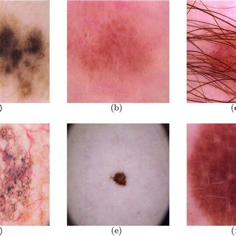 Six Examples Of The Challenges A Fuzzy Border B Low Contrast Download Scientific Diagram