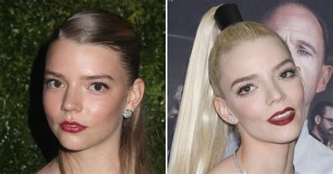 Did Anya Taylor Joy Ever Get Plastic Surgery See Transformation Photos Flipboard