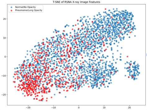 Classification Of Pneumonia In Chest X Rays Using Convolutional Neural