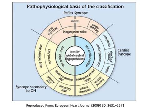 Syncope
