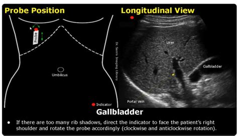 This Entry Was Posted In Dr Sams Imaging Library Gallbladder