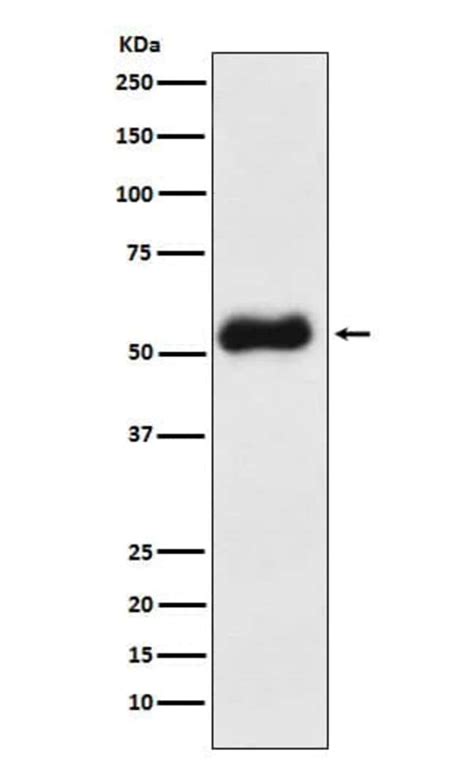 Thromboxane Synthase Antibody Sr1967 Novus Biologicals 100 μg