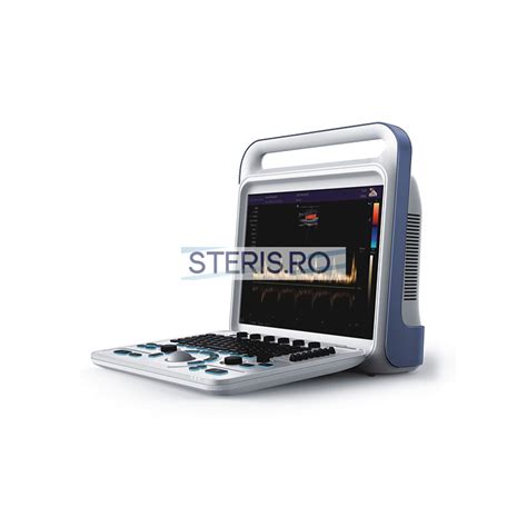 Scaner De Diagnosticare Cu Ultrasunete