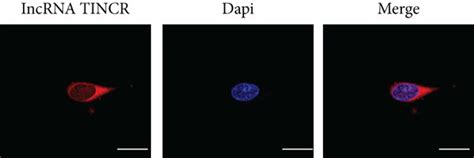 Lncrna Tincr Localized In The Cytoplasm And Interacted With Mir 375