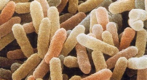 Japan Faces Surge In Streptococcal Toxic Shock Syndrome Cases