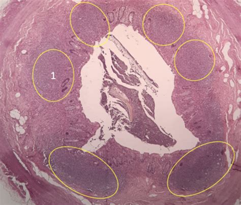 Histology Lymphatic Flashcards Quizlet Histology Lymphatic Flashcards Quizlet