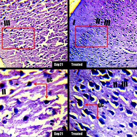 Representative Light Micrographs Of The Lateral Prefrontal Cortex Of