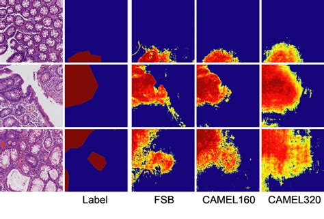 pixel level segmentation results deeplabv2 of camel on colorectal