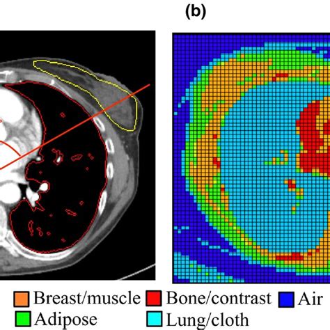 A Segmented Image And B Voxelized Patient Model Of A Female Patient