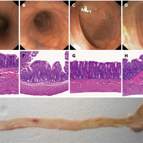 Representative Pictures Of In Vivo Colonoscopy A D Photomicrograph