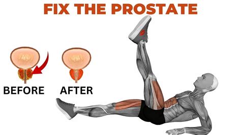 An Image Of A Man Doing Exercises With The Words Fix The Prostate