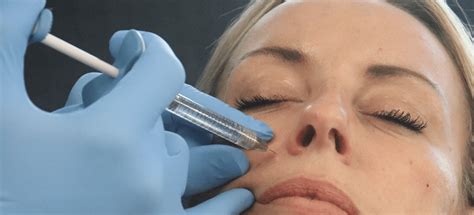 Piriform Expert Insights Benefits Of Piriformis Muscle Injection