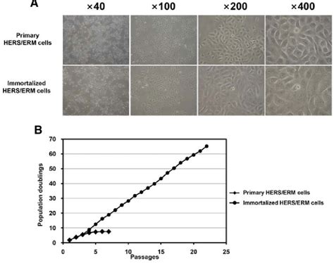 Characterization Of Primary Herserm Cells And Immortalized Herserm
