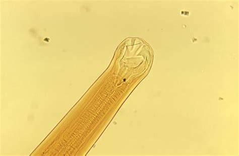 Gross Souvenir Caribbean Trip Lands Couple With Hookworm Feet Live Science