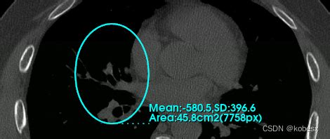 医学图像处理软件实战开发 QT C VTK 3 qt医学软件 CSDN博客