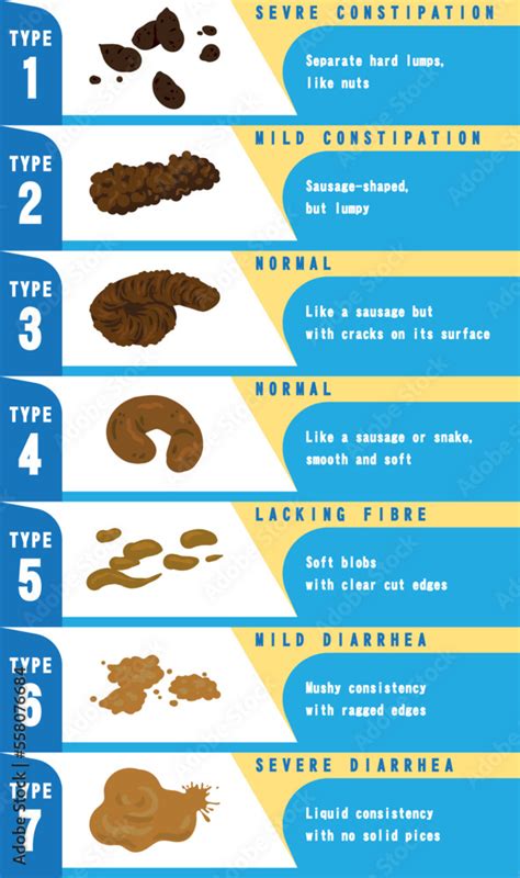 Types Of Stool