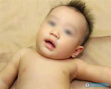 មាតាបិតា ត្រូវយល់ដឹងការវៀចករបស់ទារក Torticollis Or Wryneck សារព័ត៌មាន នគរវត្ត