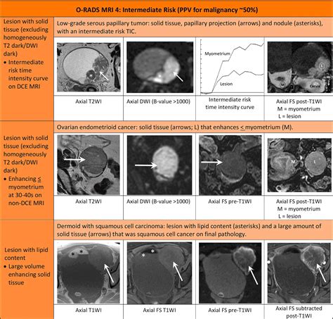 O Rads Mri Calculator Radiogyan