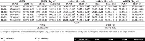 Table Viii From Prior Guided Image Reconstruction For Accelerated Multi Contrast Mri Via