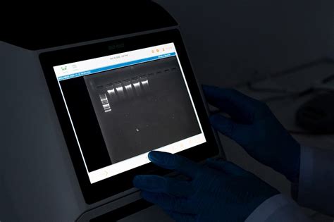 Выделение ДНК из геля