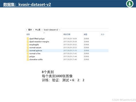 基于医学图像分类算法研究（三）——基于kvasir V2胃病数据集对transformer模型（vit，st，deit）以base基准型进行测试 Csdn博客