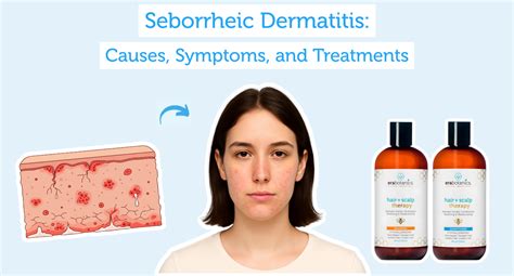 Seborrheic Dermatitis Causes Symptoms And Treatments Era Organics