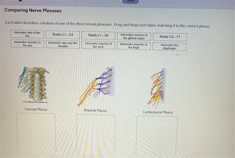 Solved Comparing Nerve Plexuses Each Label Describes A Chegg Com