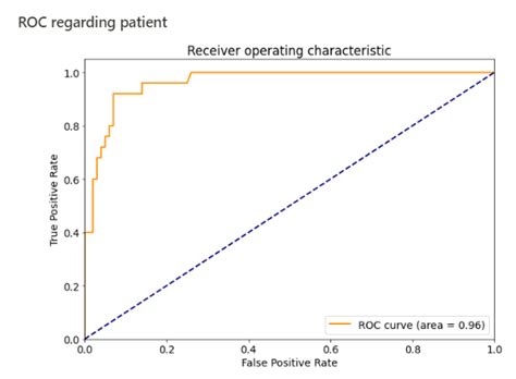 How Can A Deep Learning Algorithm Improve Fracture Detection On X Rays