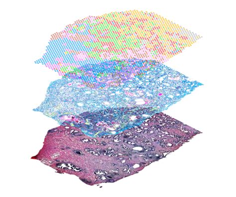 Visium Spatial Platform 10x Genomics