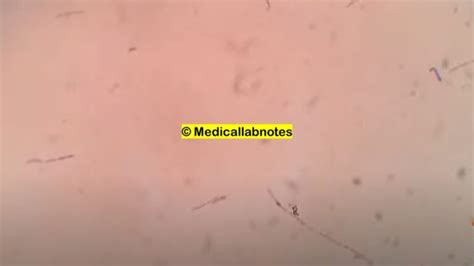 Bacillus Introduction Morphology Pathogenicity Lab Diagnosis