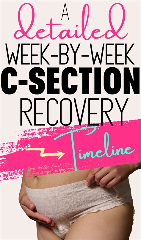 Best Sleeping Positions After A C Section Artofit