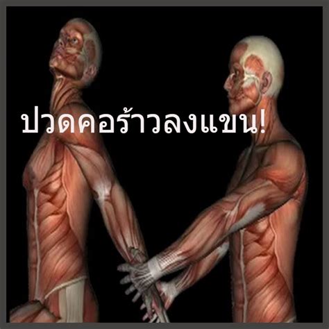 1ในโรคที่มีอาการคล้ายคอเสื่อม กล้ามเนื้ออักเสบ คือ Tos Thoracic
