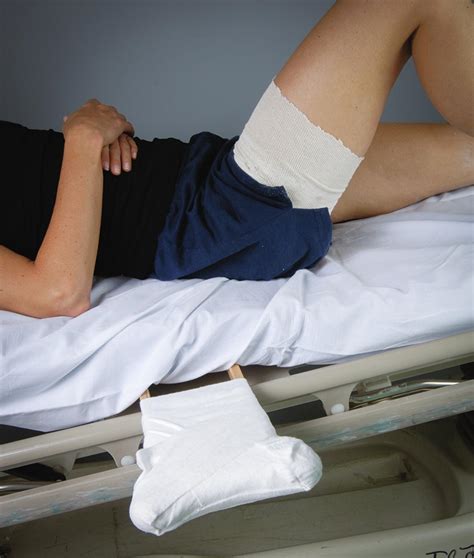 Lower Extremity Splints And Casts Clinical Tree