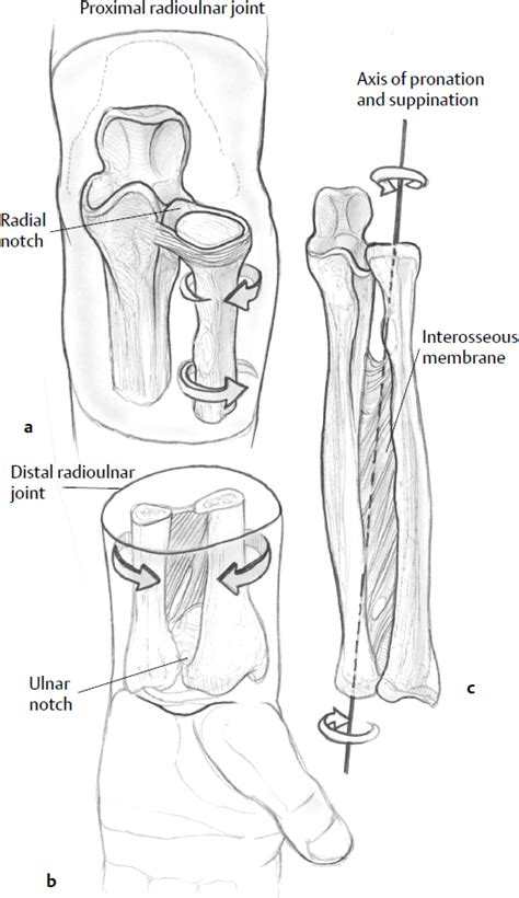 Forearm Fractures Radiology Key